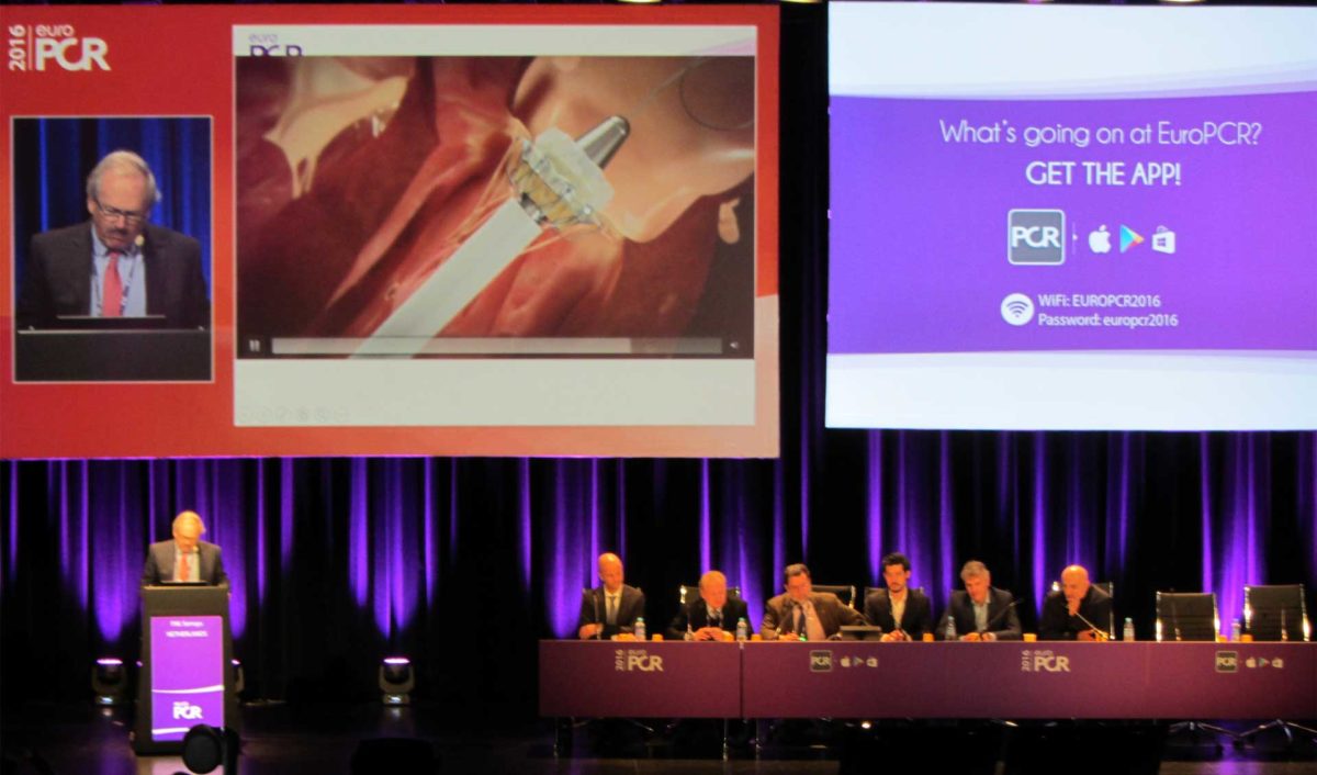 The latest progress of AccuFit™ , SINOMED TMVR, released on EuroPCR2016 ...