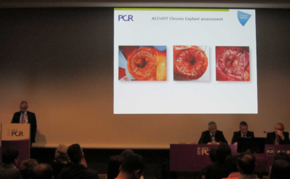 The latest progress of AccuFit™ , SINOMED TMVR, released on EuroPCR2016 ...