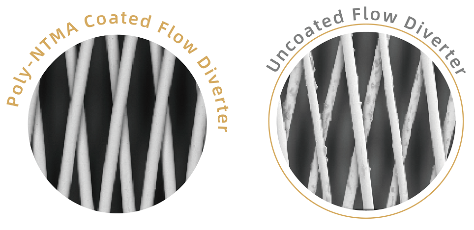 AUCURA™ Coated Flow Diverter - SINOMED